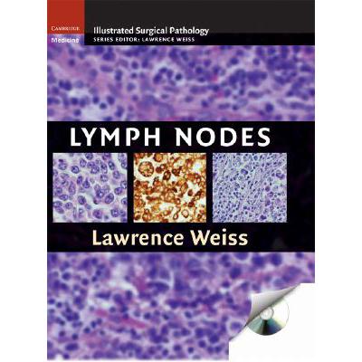 Lymph Nodes: - Lymph Nodes