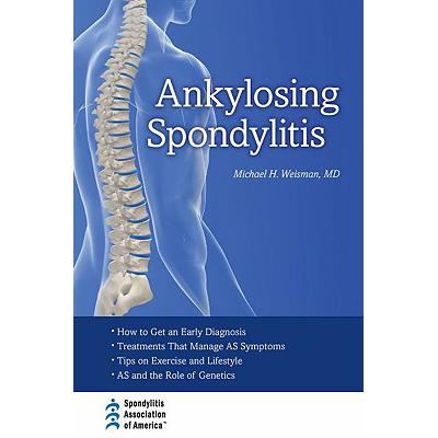 ANKYLOSING SPONDYLITIS C