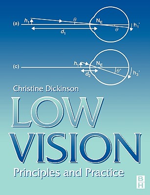 Low Vision: Principles and