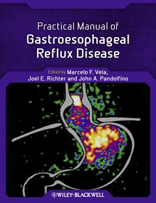 Practical Manual of Gastroesophagea
