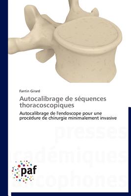 Autocalibrage de S Quence