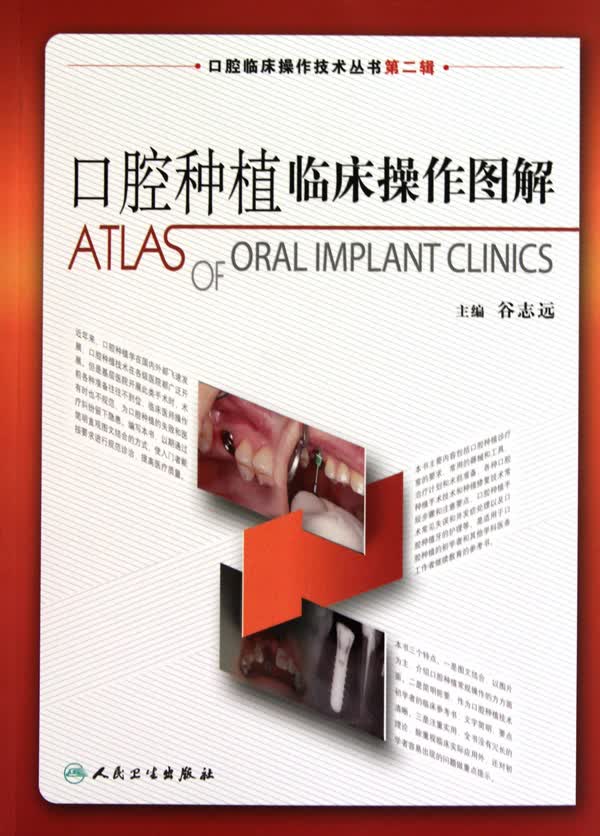 口腔种植临床操作图解/口腔临床操作技术丛书