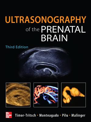 Ultrasonography of the Prenatal