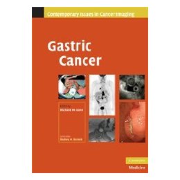 Gastric Cancer