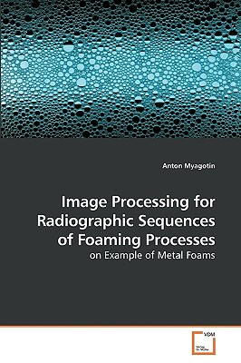 Image Processing for Radiographi