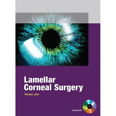 LAMELLAR CORNEAL SURGERY WITH CD