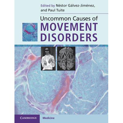 现货 Uncommon Causes of Movement Disorders