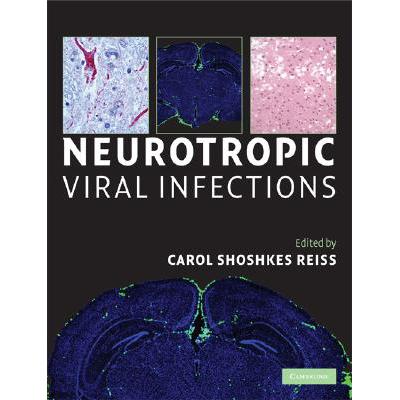 Neurotropic Viral Infections