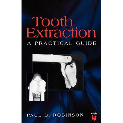 Tooth Extraction: A Practical Guide