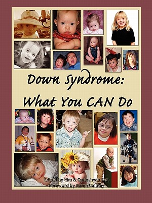 Down Syndrome: What You Can Do