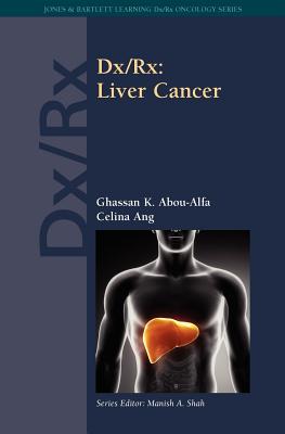 DX/RX: Liver Cancer