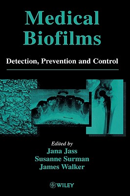 Medical Biofilms - Detection, Prevention