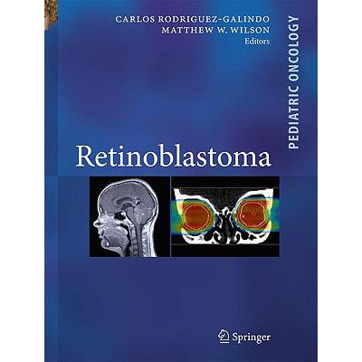 Retinoblastoma