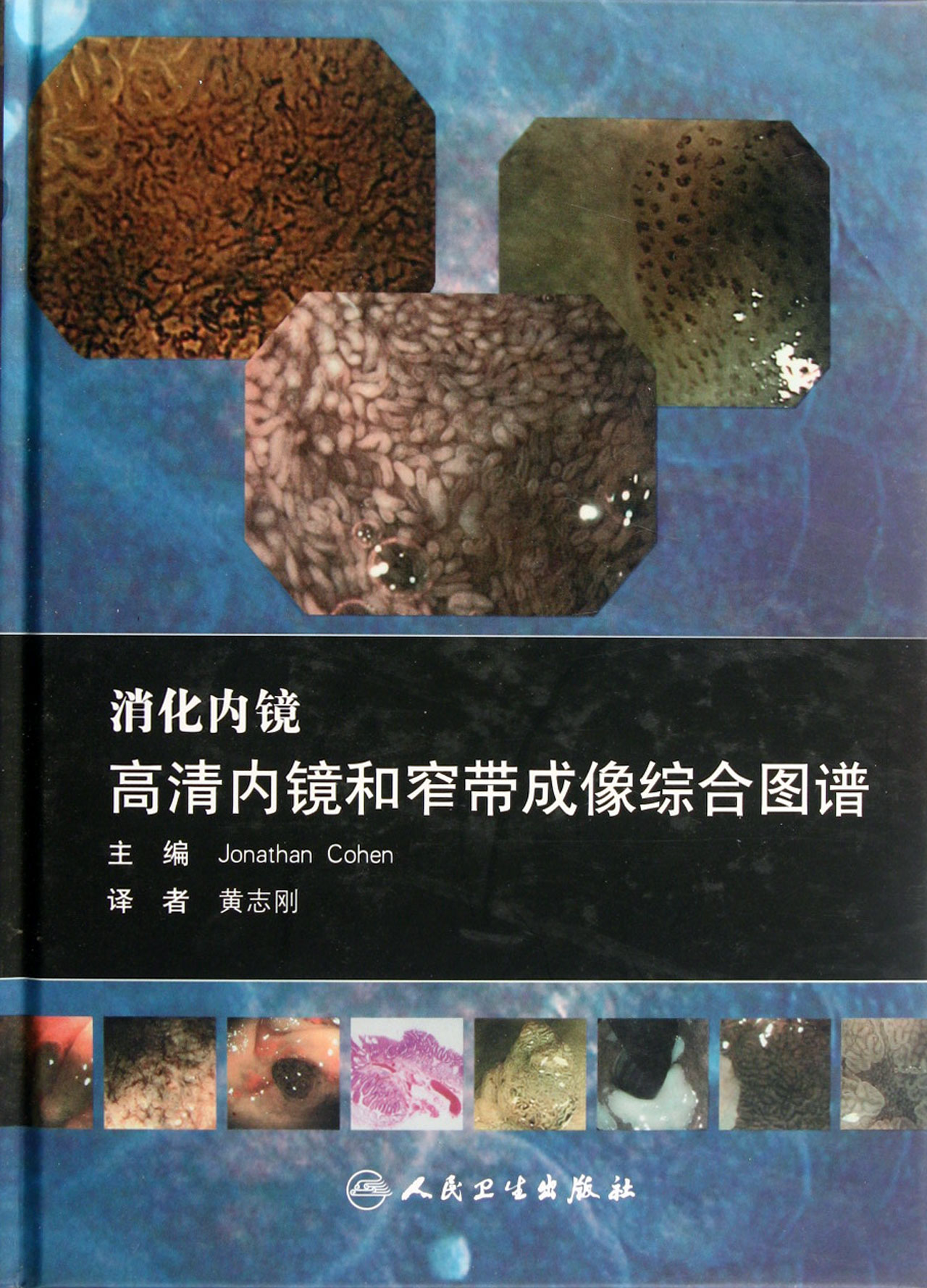 消化内镜高清内镜和窄带成像综合图谱(附光盘)(精)