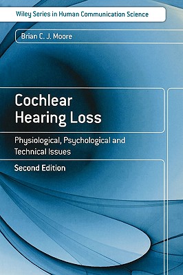 Cochlear Hearing Loss - Physiological,
