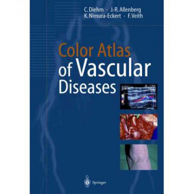 Color Atlas of Vascular Diseases