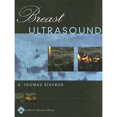 Breast Ultrasound