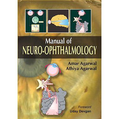 Manual of Neuro-Ophthalmology
