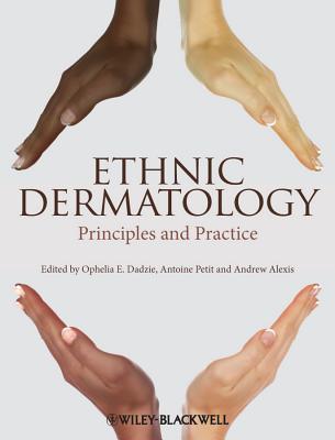 Ethnic Dermatology: Principles and