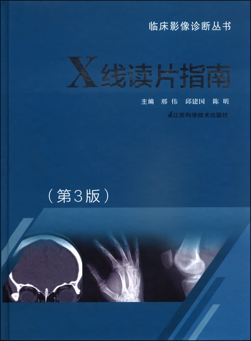 临床影像诊断丛书：X线读片指南（第3版）