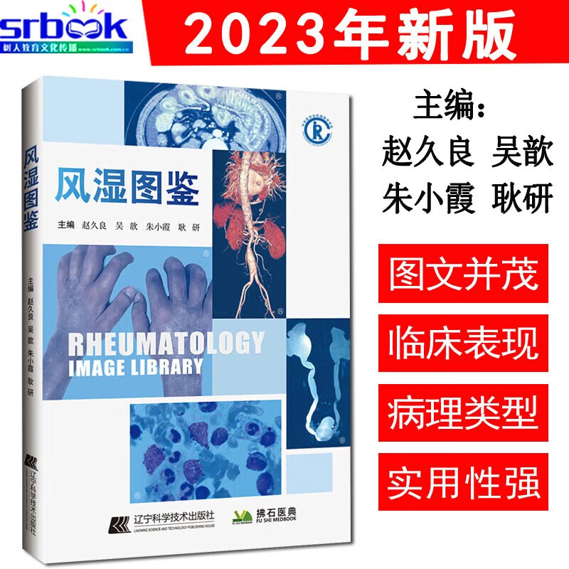 现货速发 风湿图鉴 赵久良 吴歆 朱小霞 耿研 痛风关节炎红斑等风湿疾病临床表现影像学检查及实验室诊断 辽宁科学技术出版社9787559129253
