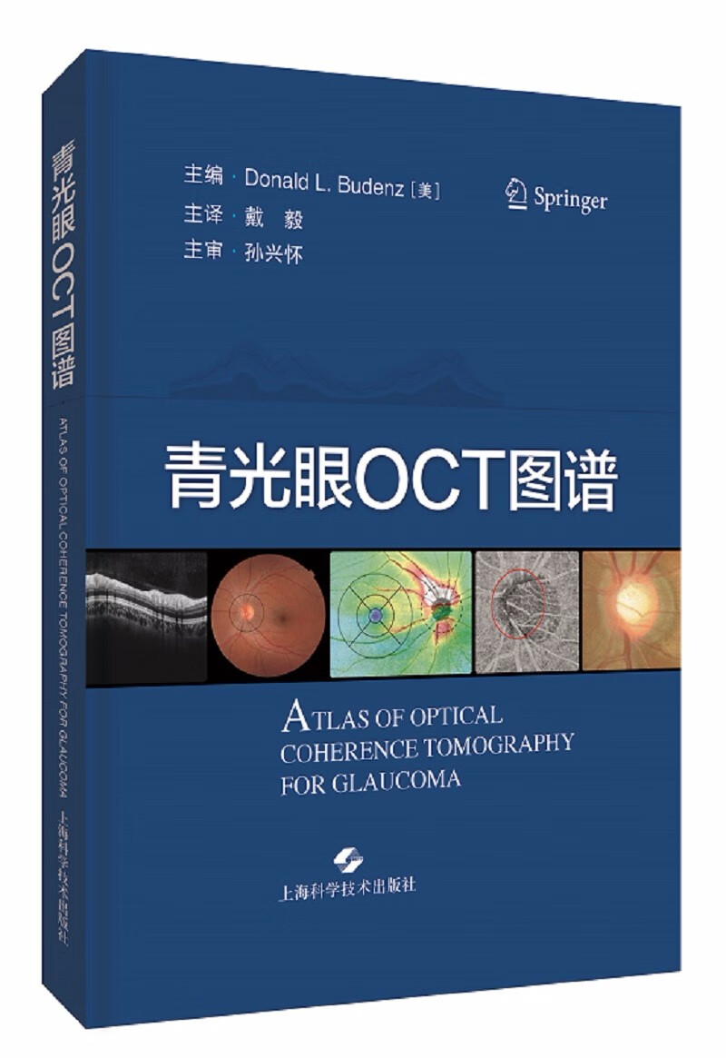 青光眼OCT图谱