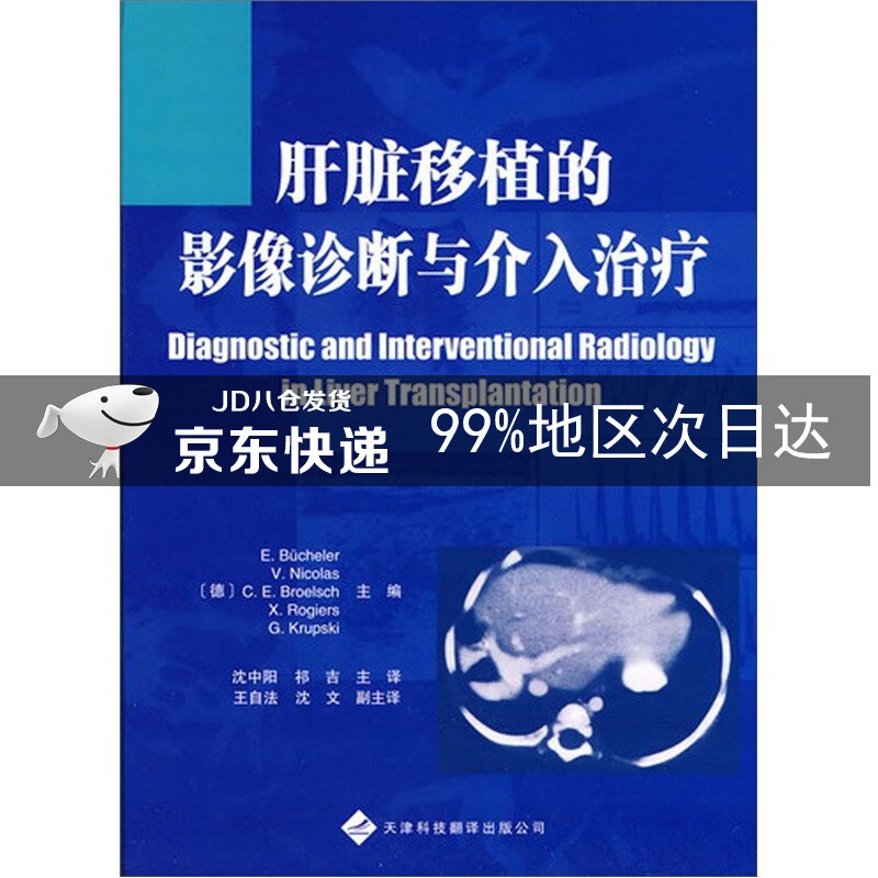 肝脏移植的影像诊断与介入治疗