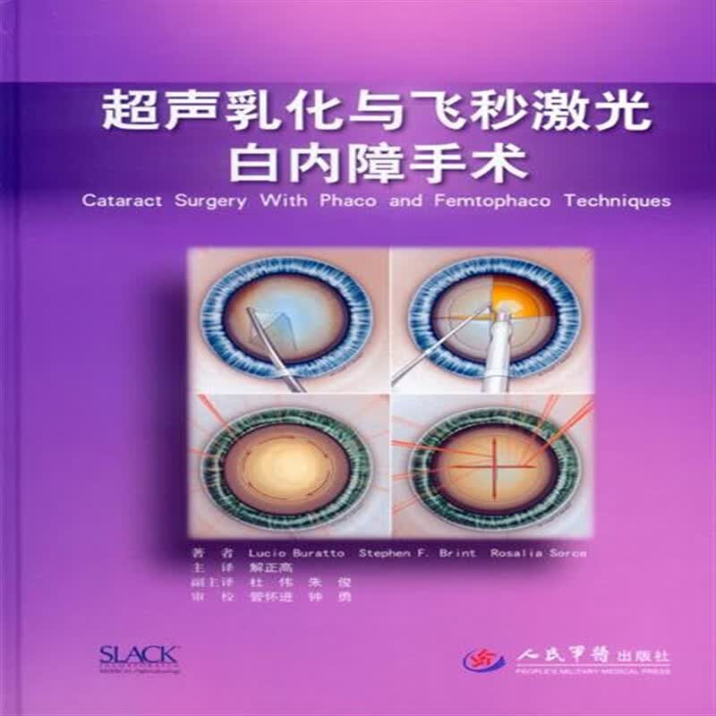 超声乳化与飞秒激光手术 手术
