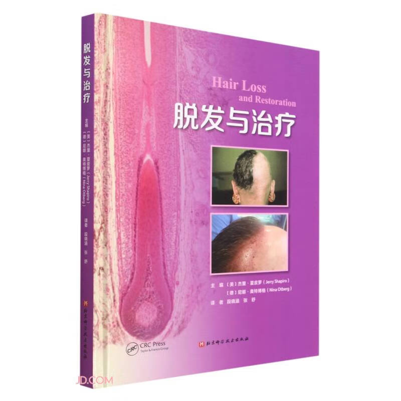 脱发与治疗(精)