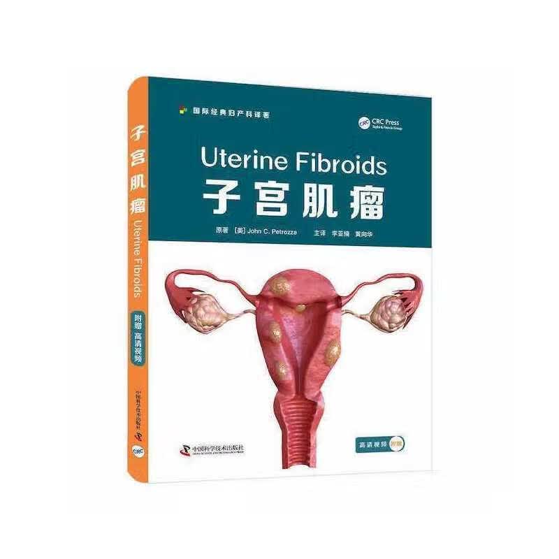子宫肌瘤