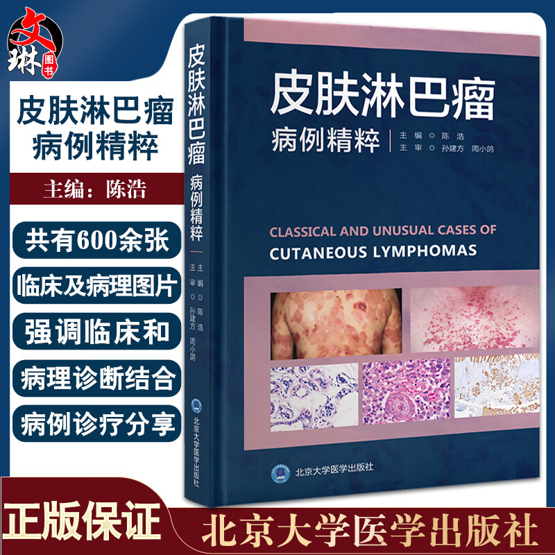 皮肤淋巴瘤病例精粹 陈浩 临床实践真实病例 适合临床皮肤科医师病理医师血液肿瘤科医师等使用 北京大学医学出版社9787565927072