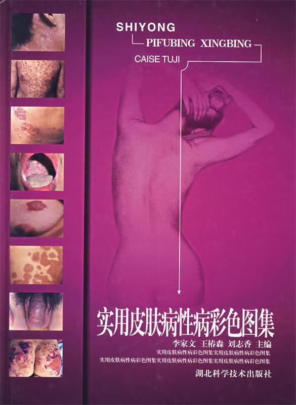 实用皮肤病性病彩色图集