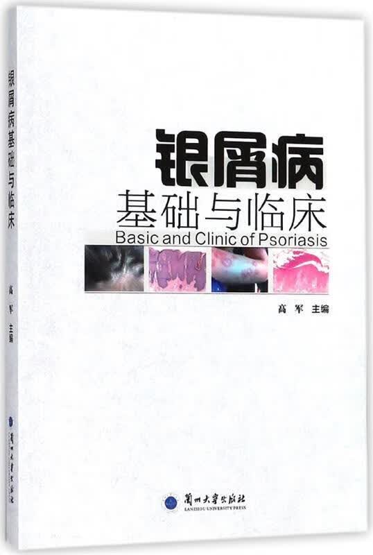 银屑病基础与临床 高军