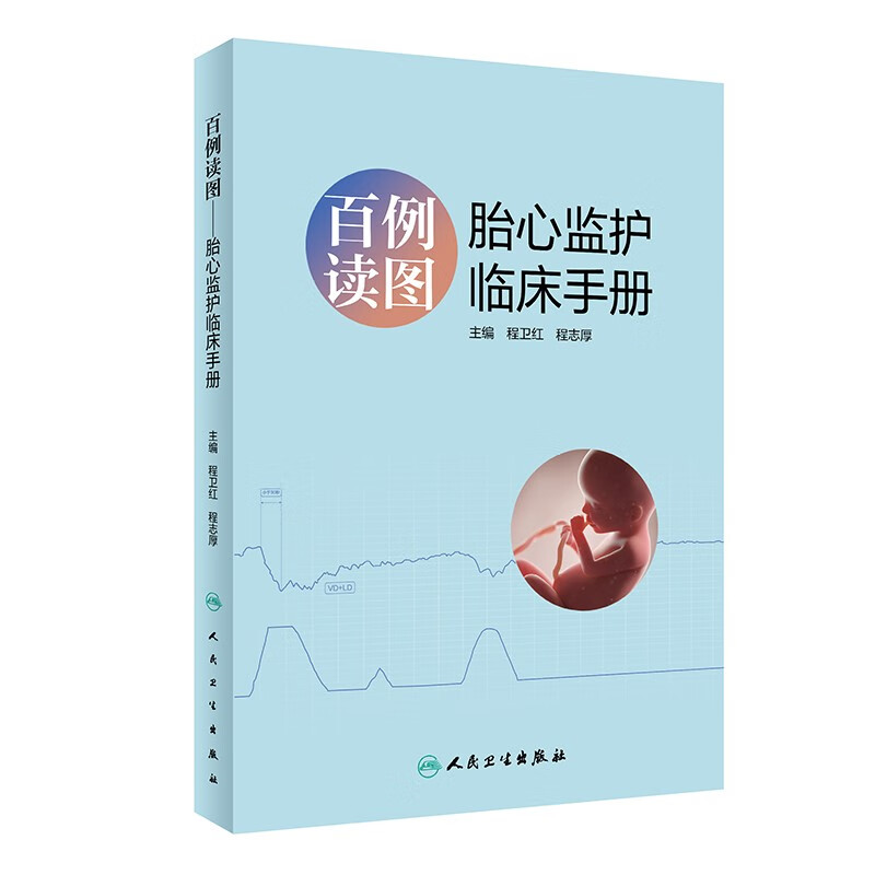 百例读图·胎心监护临床手册