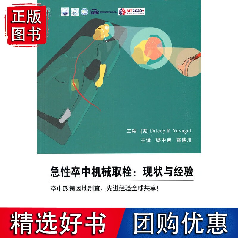 急性卒中机械取栓：现状与经验