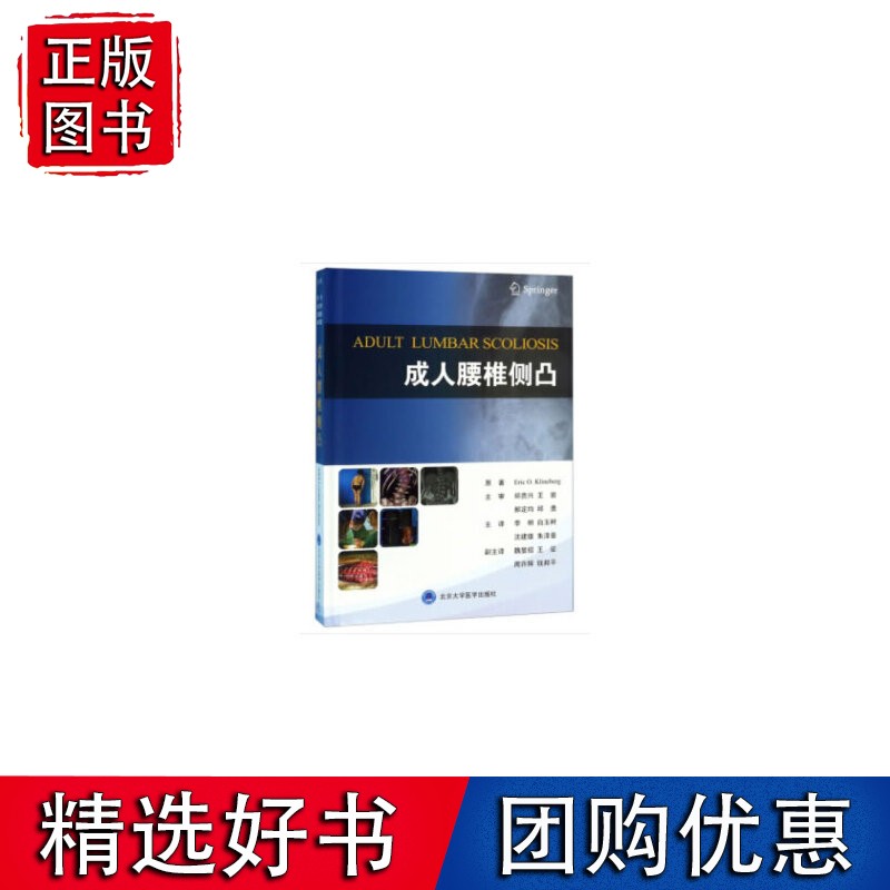 腰椎侧凸