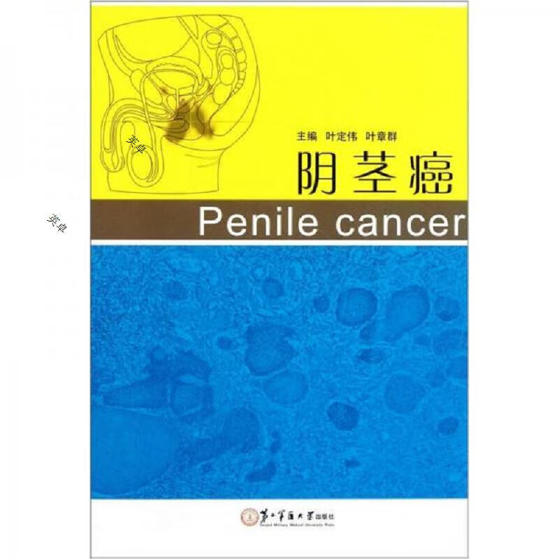 阴茎癌