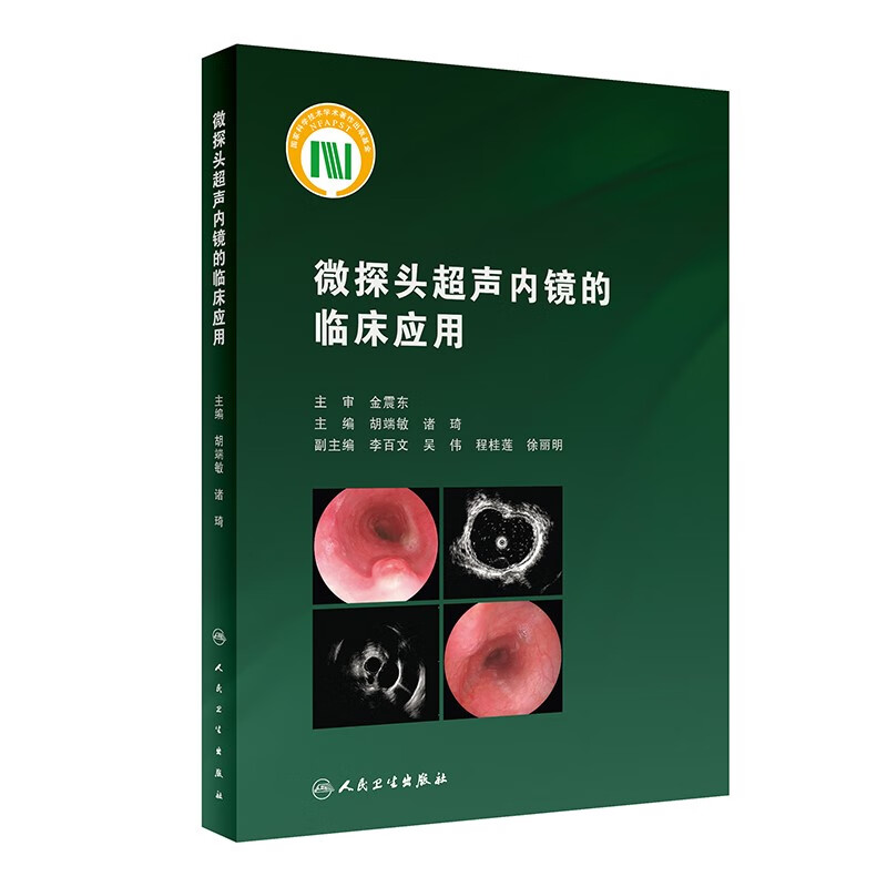 微探头超声内镜的临床应用