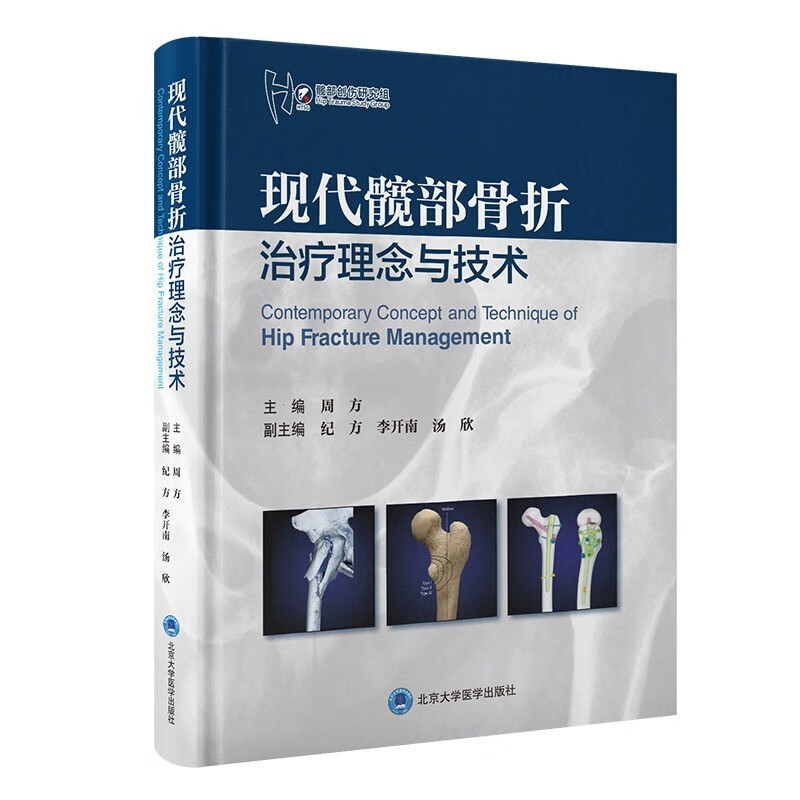现代髋部骨折治疗理念与技术 周方 主编 实用骨科学黄家驷骨科学骨外科髋关节外科手术 北京大学医学出版社9787565927423