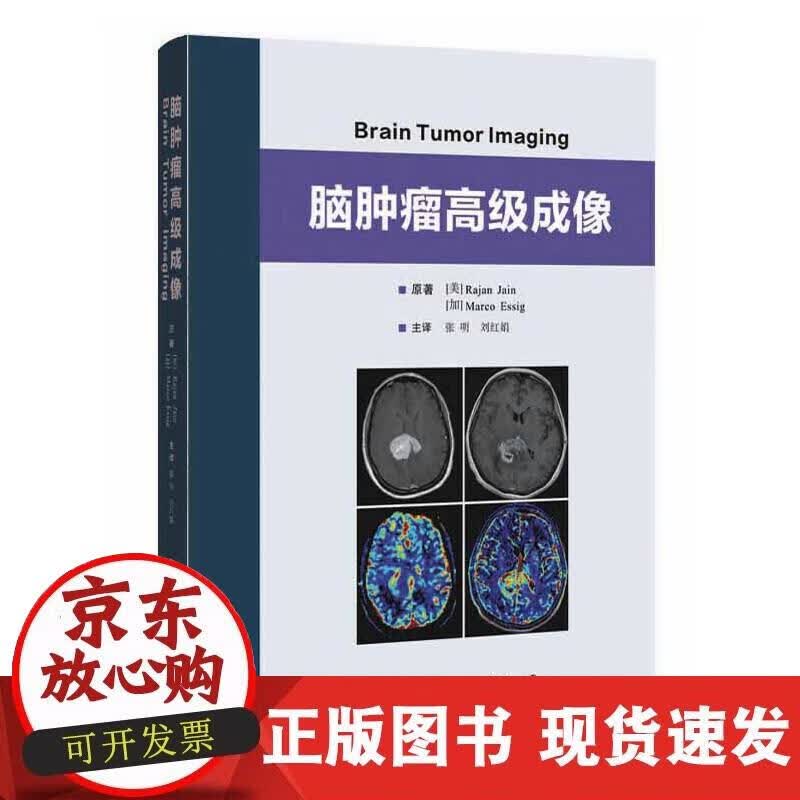 【现货】脑肿瘤成像