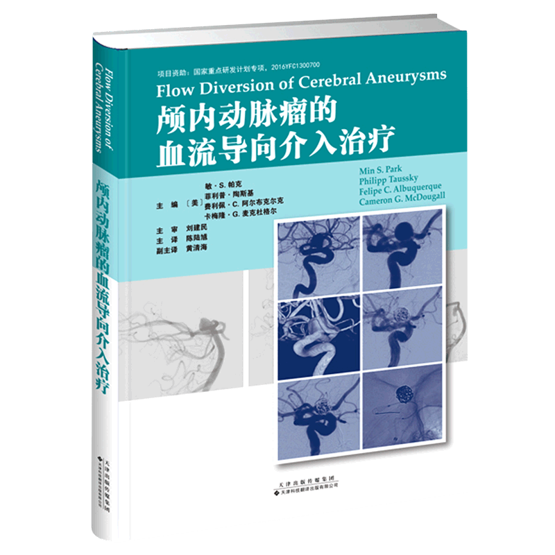 颅内动脉瘤的血流导向介入治疗(精)