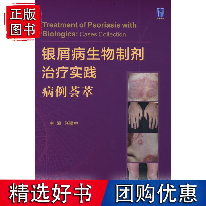 银屑病生物制剂治疗实践 病例荟萃