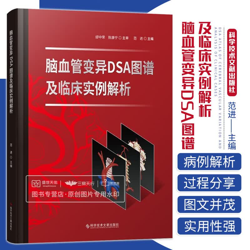 脑血管变异DSA图谱及临床实例解析 范进主编 针对神经介入中脑血管变异 针对脑血管变异手术策略 医学类丛书 科学技术文献出版社