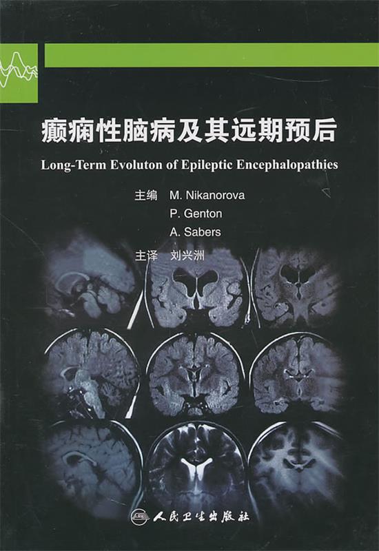癫痫性脑病及其远期预后