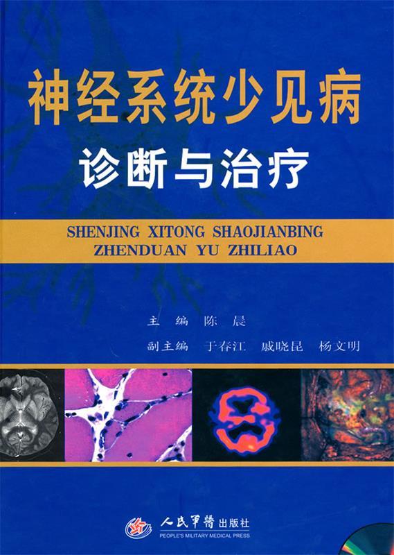 神经系统少见病诊断与治疗