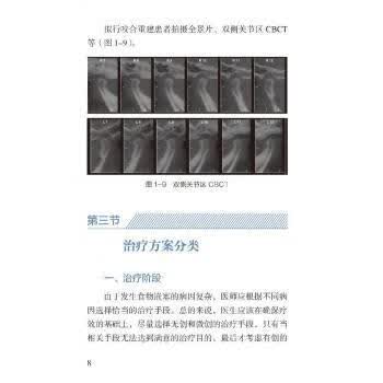 食物嵌塞的修复治疗
