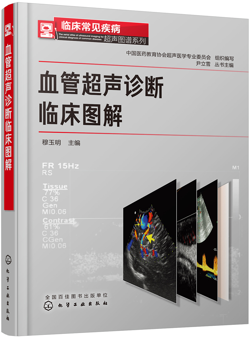 临床常见疾病超声图谱系列--血管超声诊断临床图解