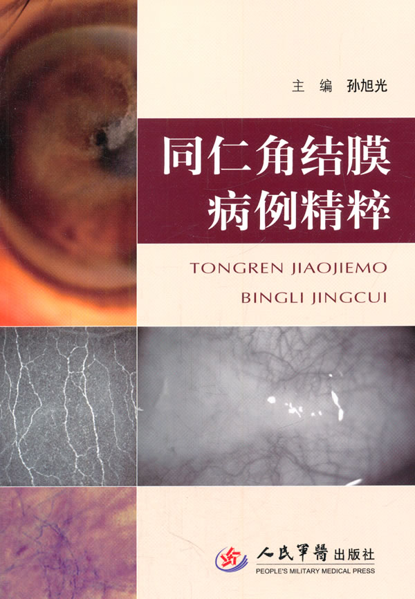 同仁角结膜病例精粹 孙旭光【书】
