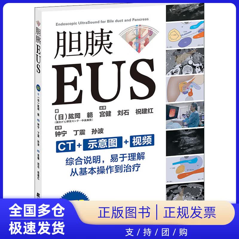 胆胰EUS(日)肱岡 範