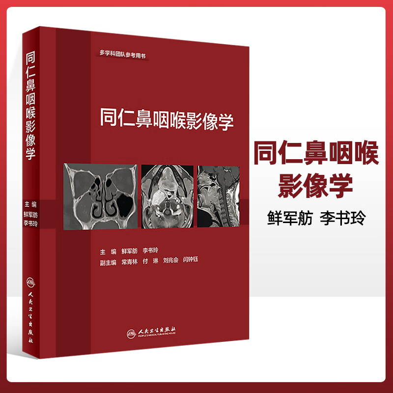 同仁鼻咽喉影像学 鼻与鼻窦影像学检查方法及影像解剖鼻咽喉疾病临床表现治疗原则影像学检查方法主编鲜军舫李书玲 人民卫生出版社